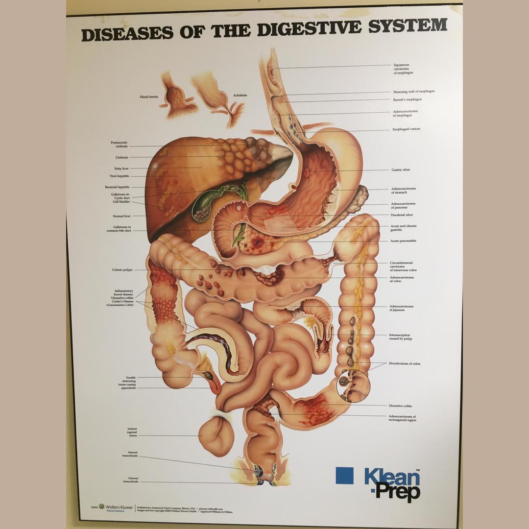 Diseases of the digestive system